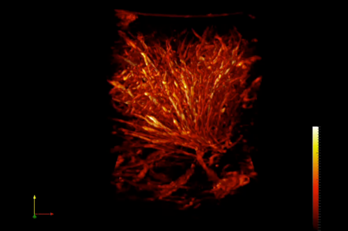 Image-guided Neurosurgery – CUBE